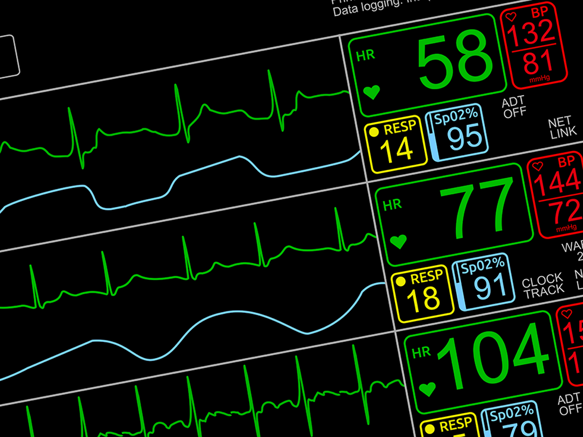 FRC scheme for lower damages clinical negligence claims: key changes ...